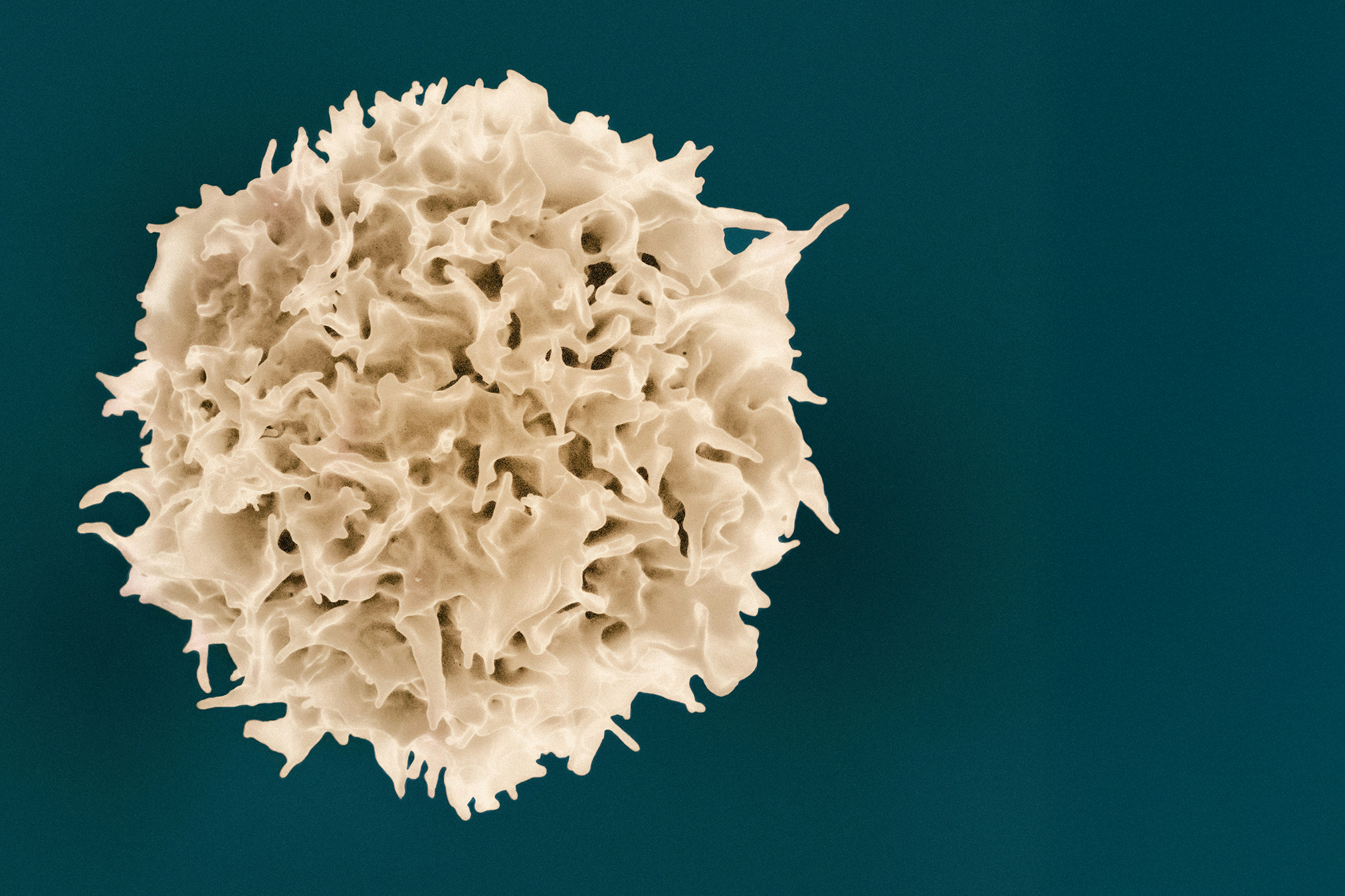 TIRTL-seq: Making Paired TCR Sequencing Deep, Affordable, and Scalable